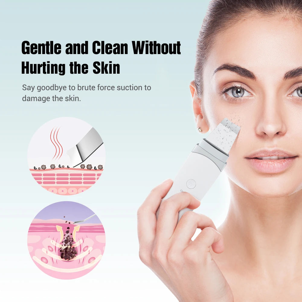 Ultrasonic Derma Skin Scrubber Pen Blackhead Facial Cleaner ...